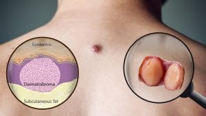 Dr Haitham Fekry – إستشاري جراحات الأورام في المعهد القومي للأورام ...